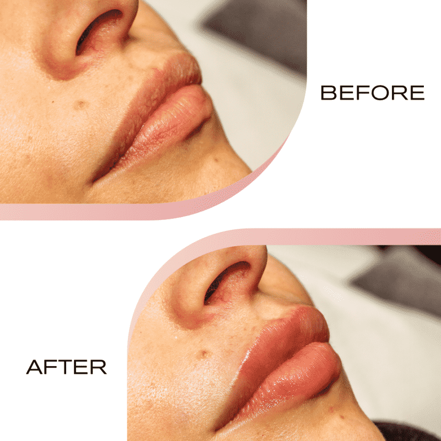 Lightsculpt - Social Media - Solid Projects